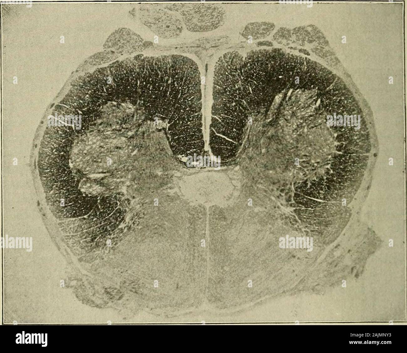 A system of medicine, by many writers; . it—degenerate and disappear in ...