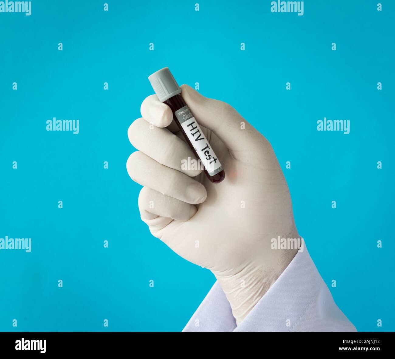 Blood test tubes hiv hi-res stock photography and images - Alamy