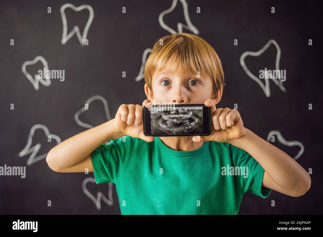 The boy shows his X-ray image of his teeth with an abnormally strange ...