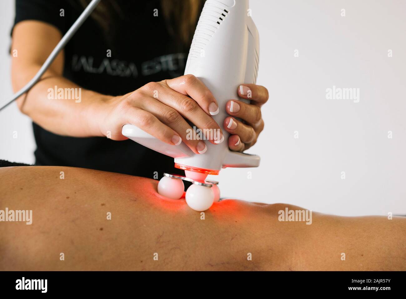 Cellulite hi-res stock photography and images - Alamy