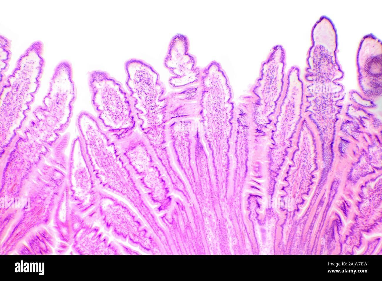 Сross-section of the small intestine under the microscope (Small ...