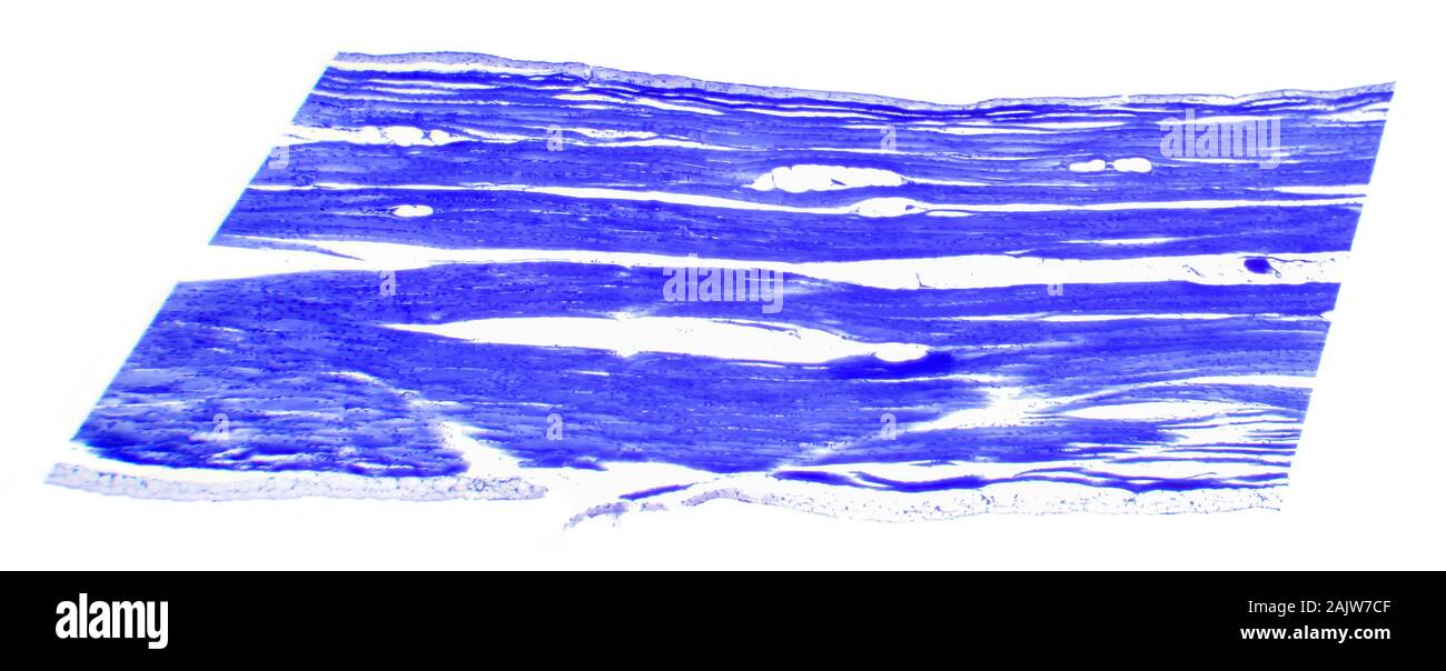 Skeletal muscle tissue cross-section under a microscope, Skeletal ...