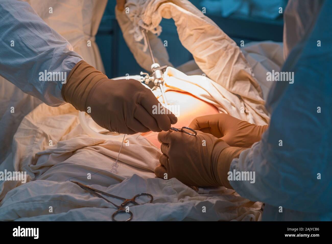Laparoscopic surgery hi-res stock photography and images - Alamy
