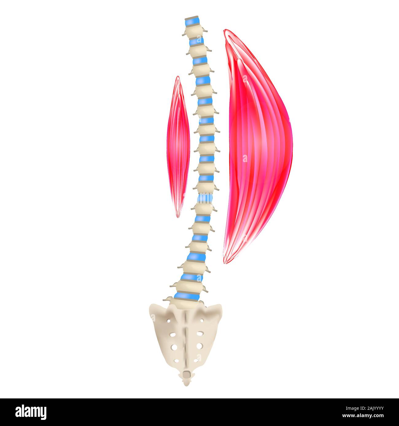 Left-sided scoliosis. Levoscoliosis. Muscles and spine. Spinal ...