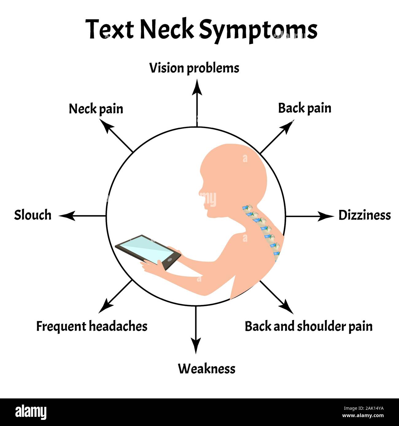 Text neck syndrome Cut Out Stock Images & Pictures - Alamy
