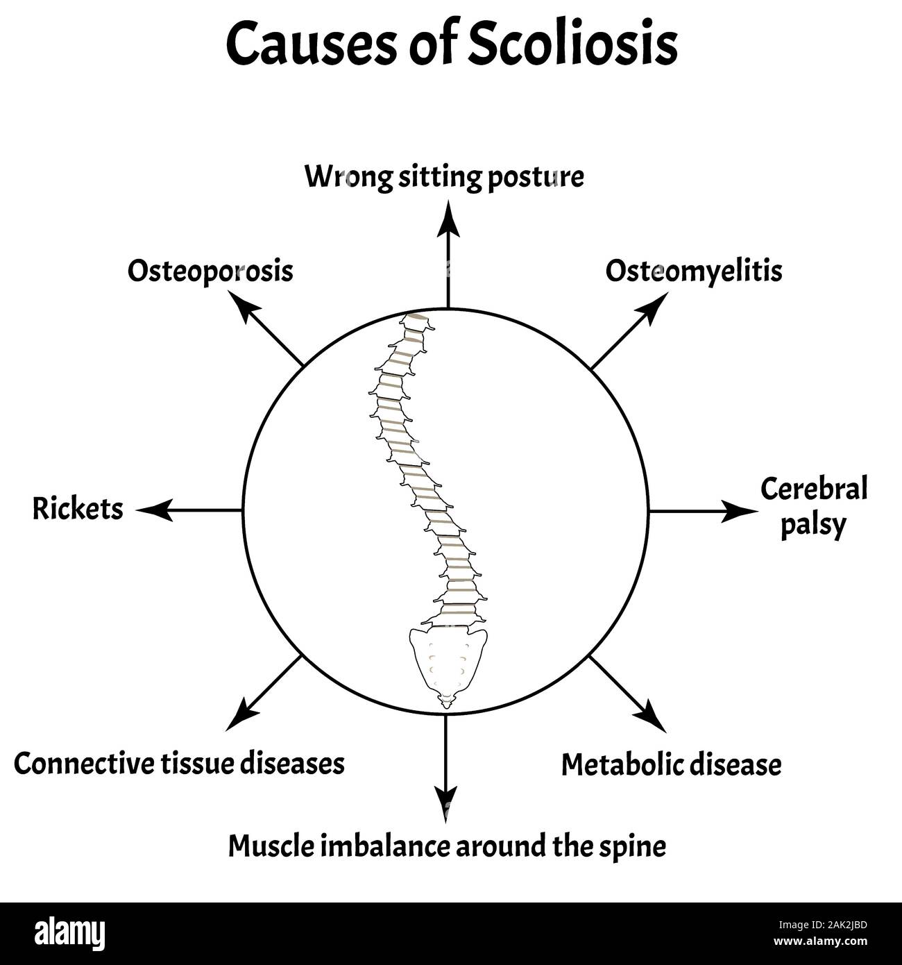 Scoliosis Vest at Carolyn Huddleston blog