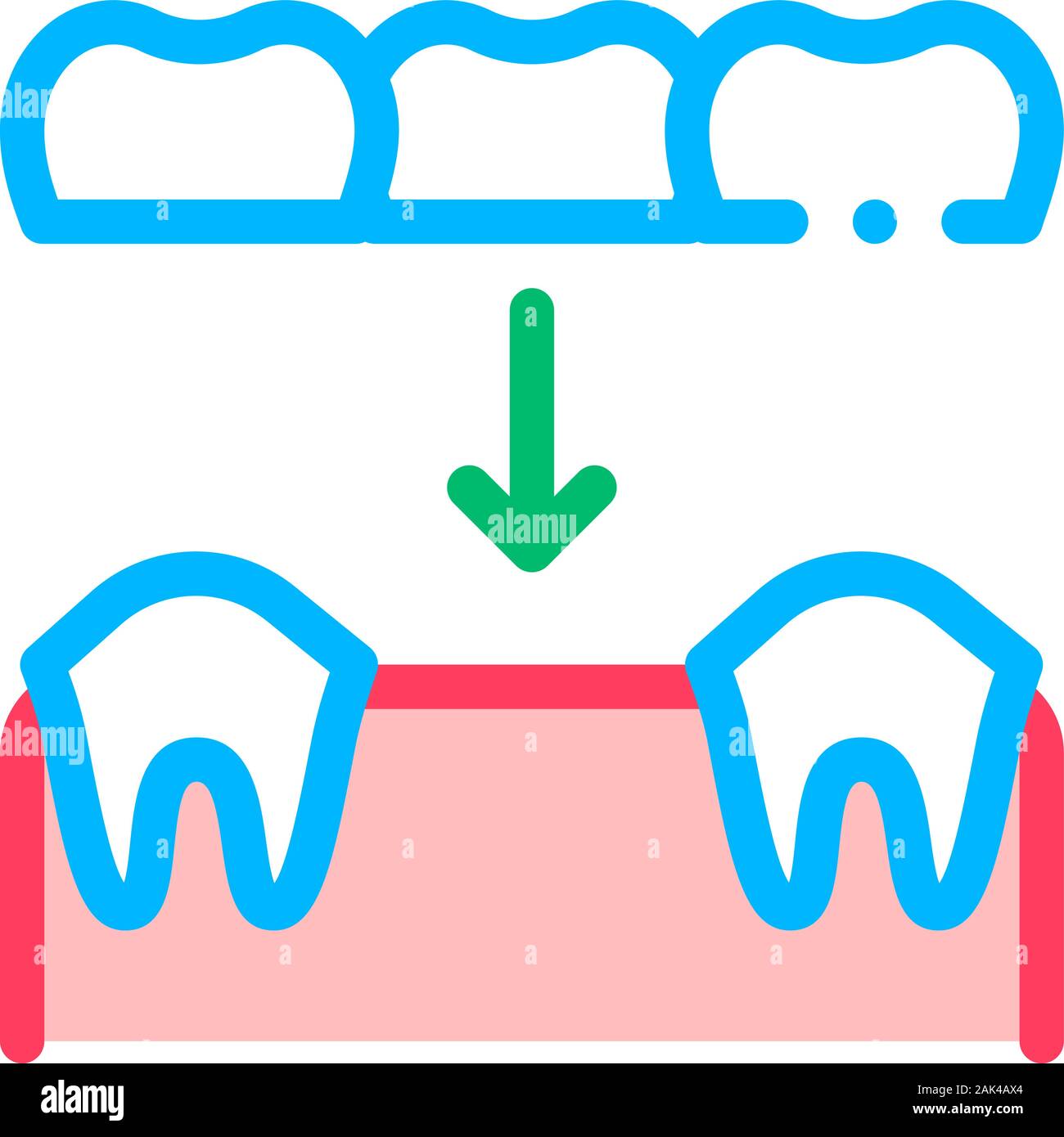 Dental Prosthesis Stomatology Vector Sign Icon Stock Vector Image & Art ...
