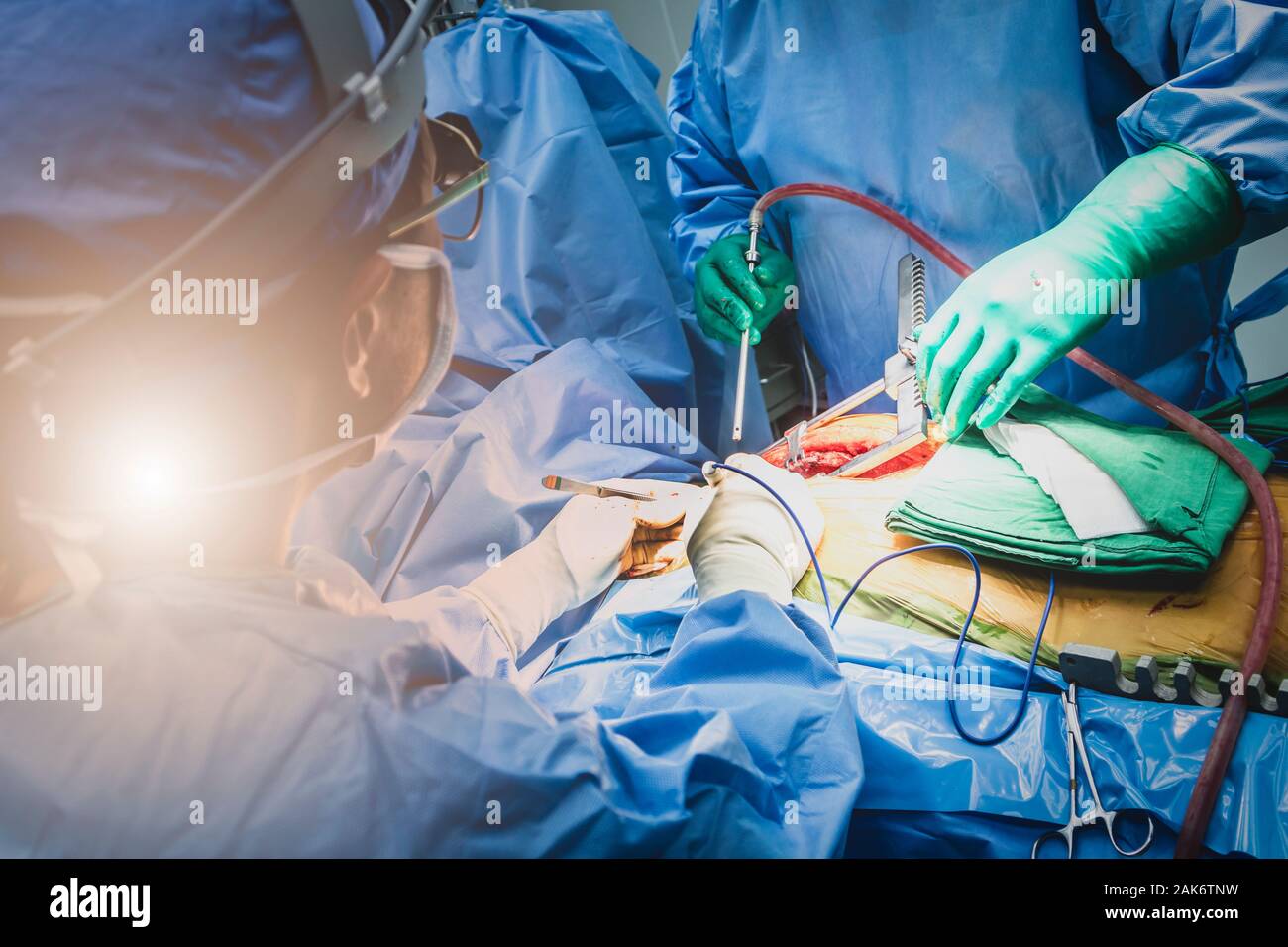 Close up group of surgeons in Surgery operating room. Medical team of ...
