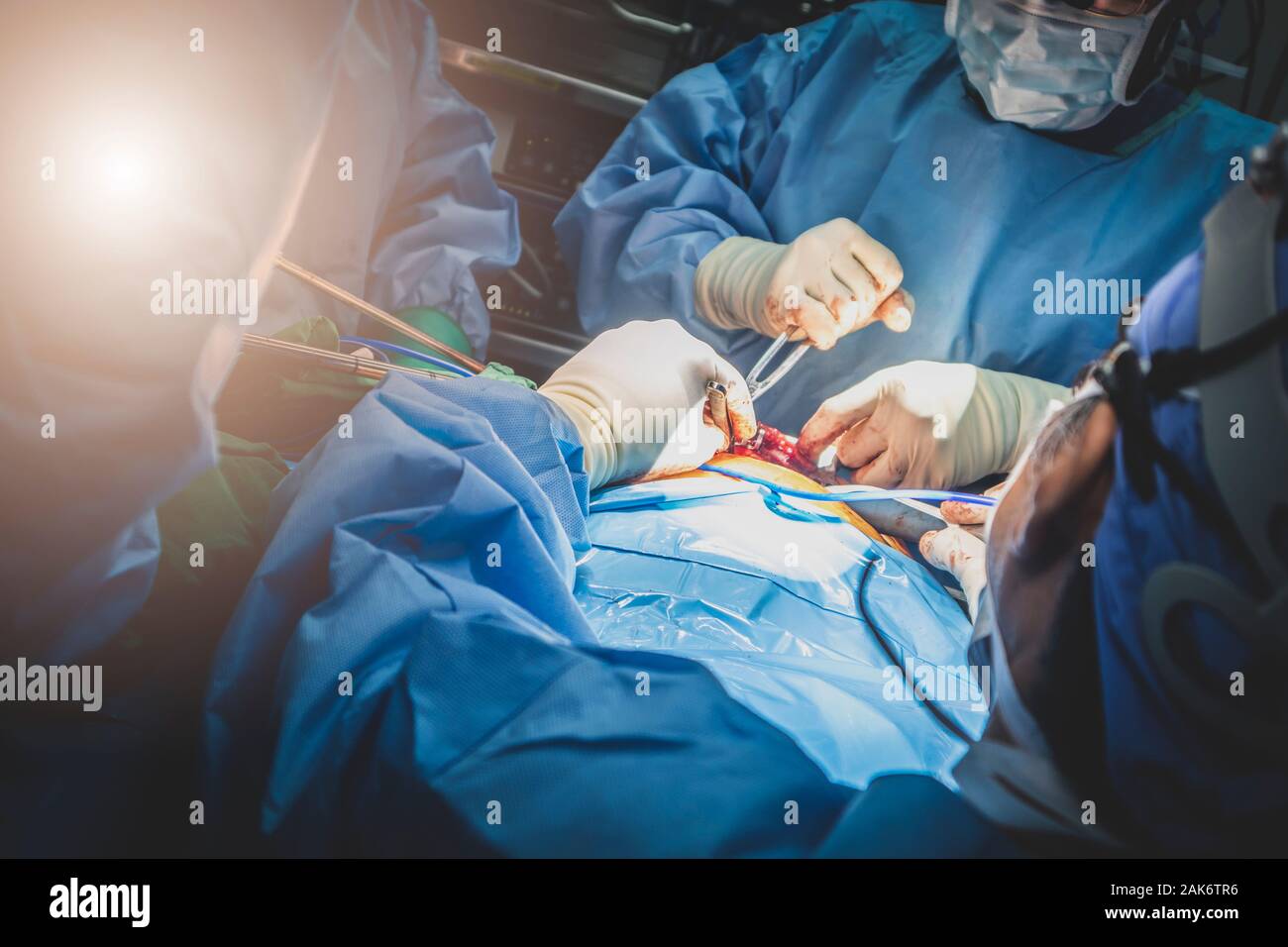 Close up group of surgeons in Surgery operating room. Medical team of ...