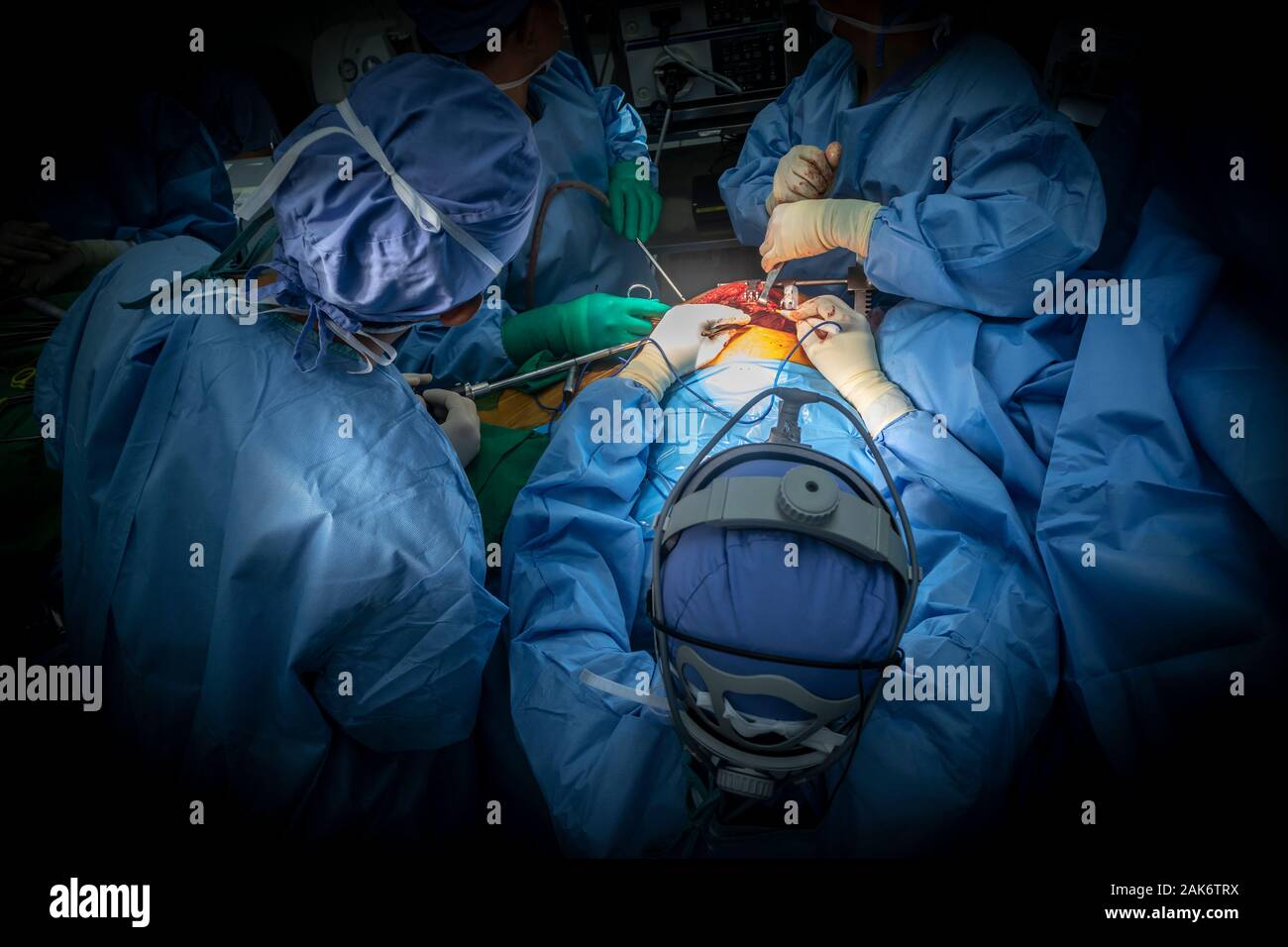 Minimal invasive surgery hi-res stock photography and images - Alamy