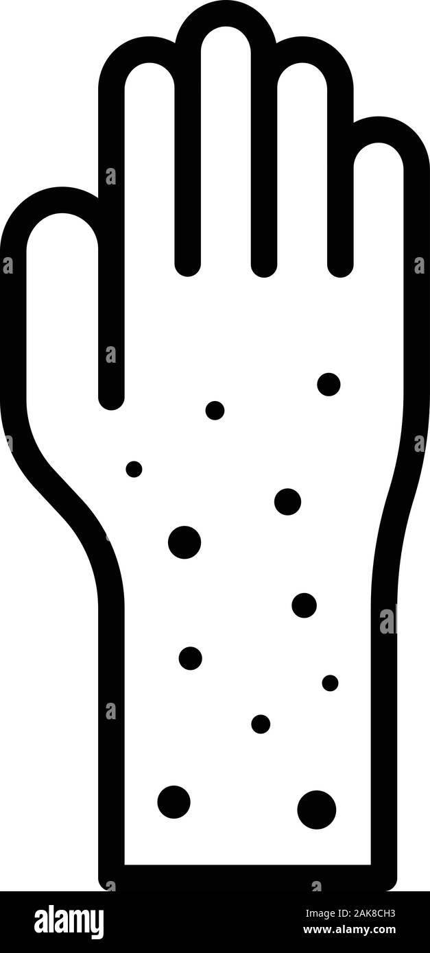 Hand allergy icon, outline style Stock Vector Image & Art - Alamy