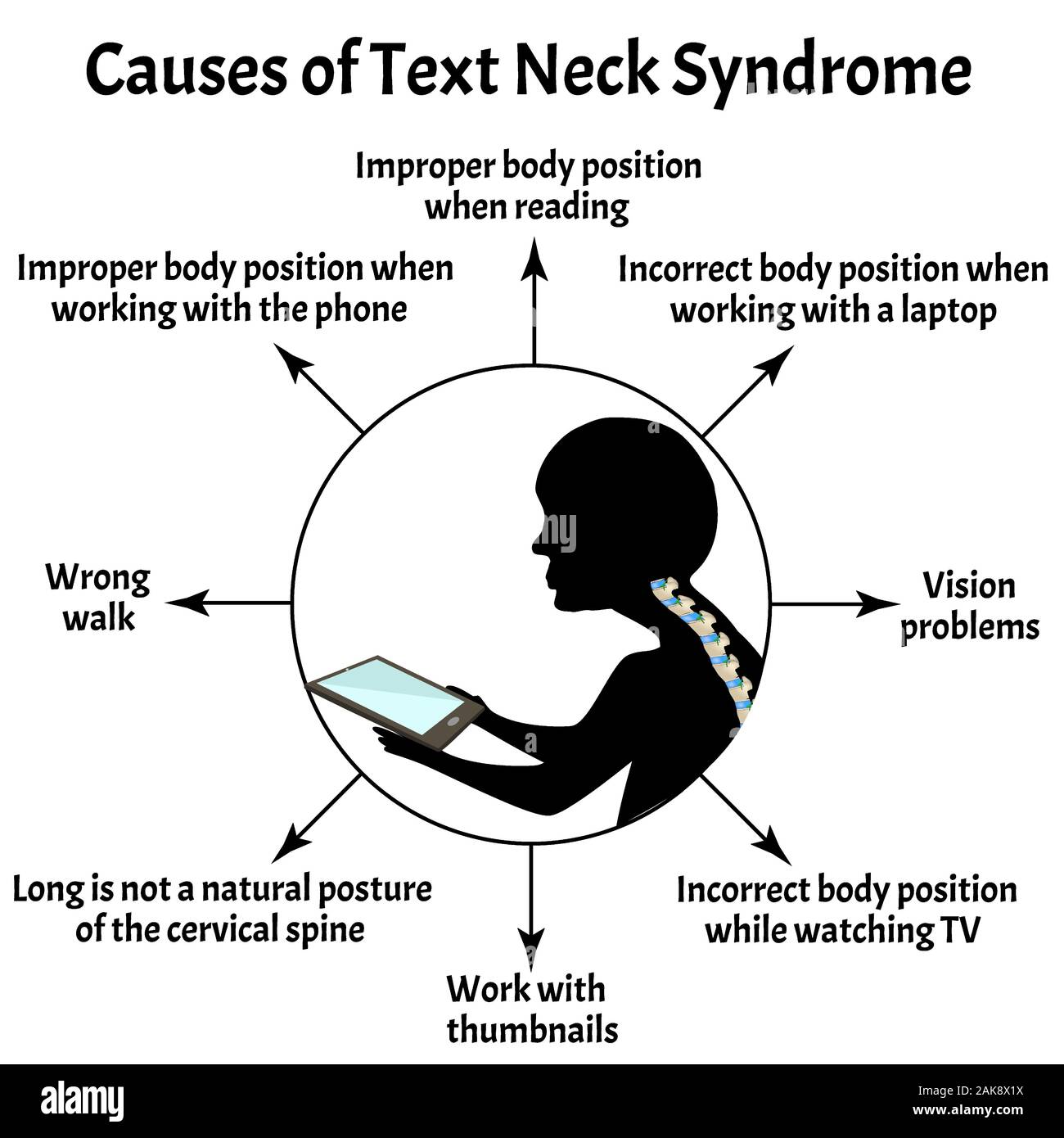 Causes of Text Neck Syndrome. Spinal curvature, kyphosis, lordosis of ...