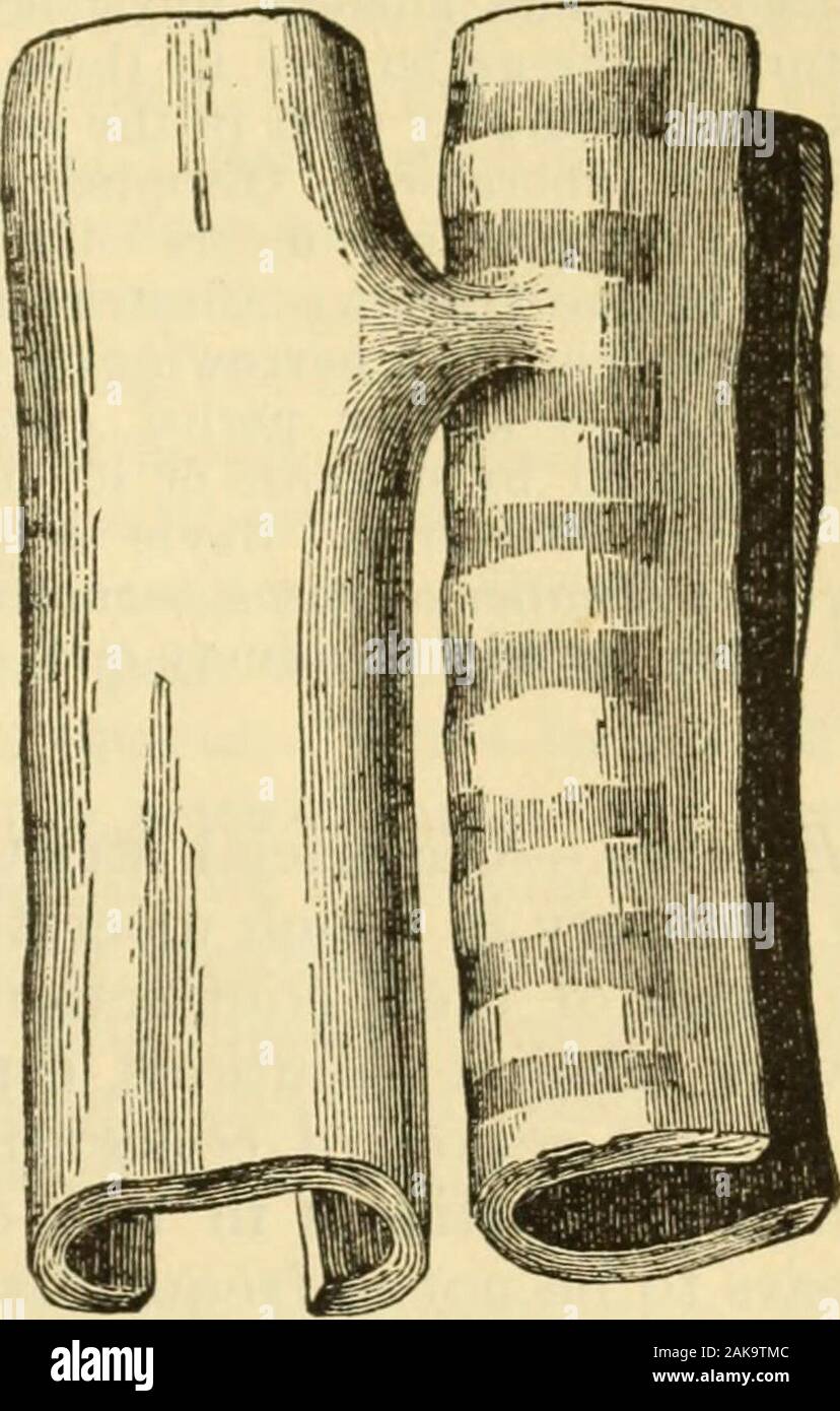 A manual of diseases of the throat and nose : including the pharynx ...