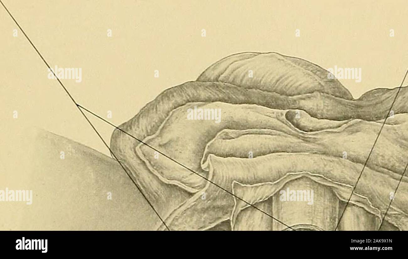 Surgical anatomy : a treatise on human anatomy in its application to ...