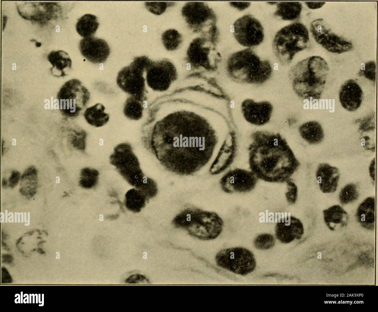 Report of first expedition to South America, 1913 . Fig. 1. — Liver ...