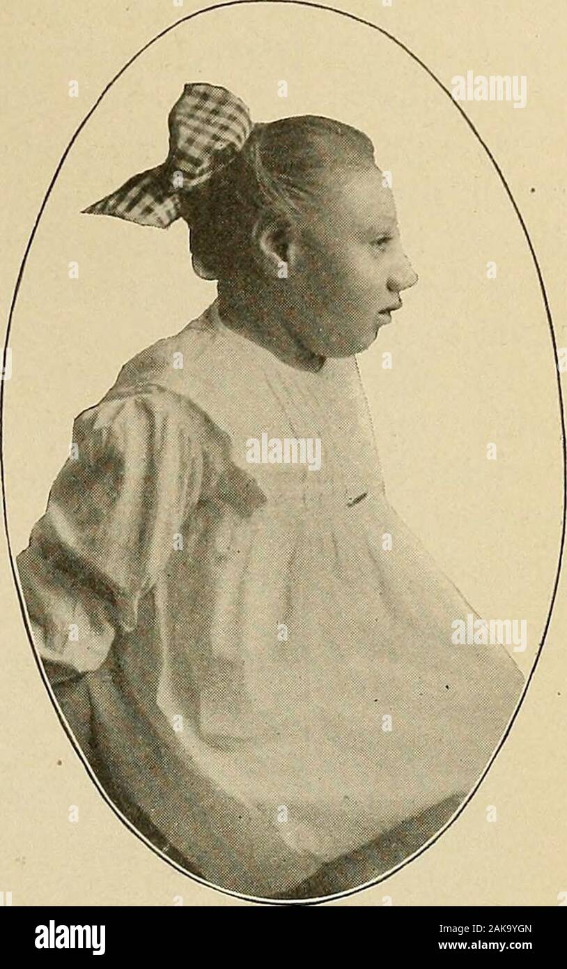 Diseases of the nervous system : a text-book of neurology and ...