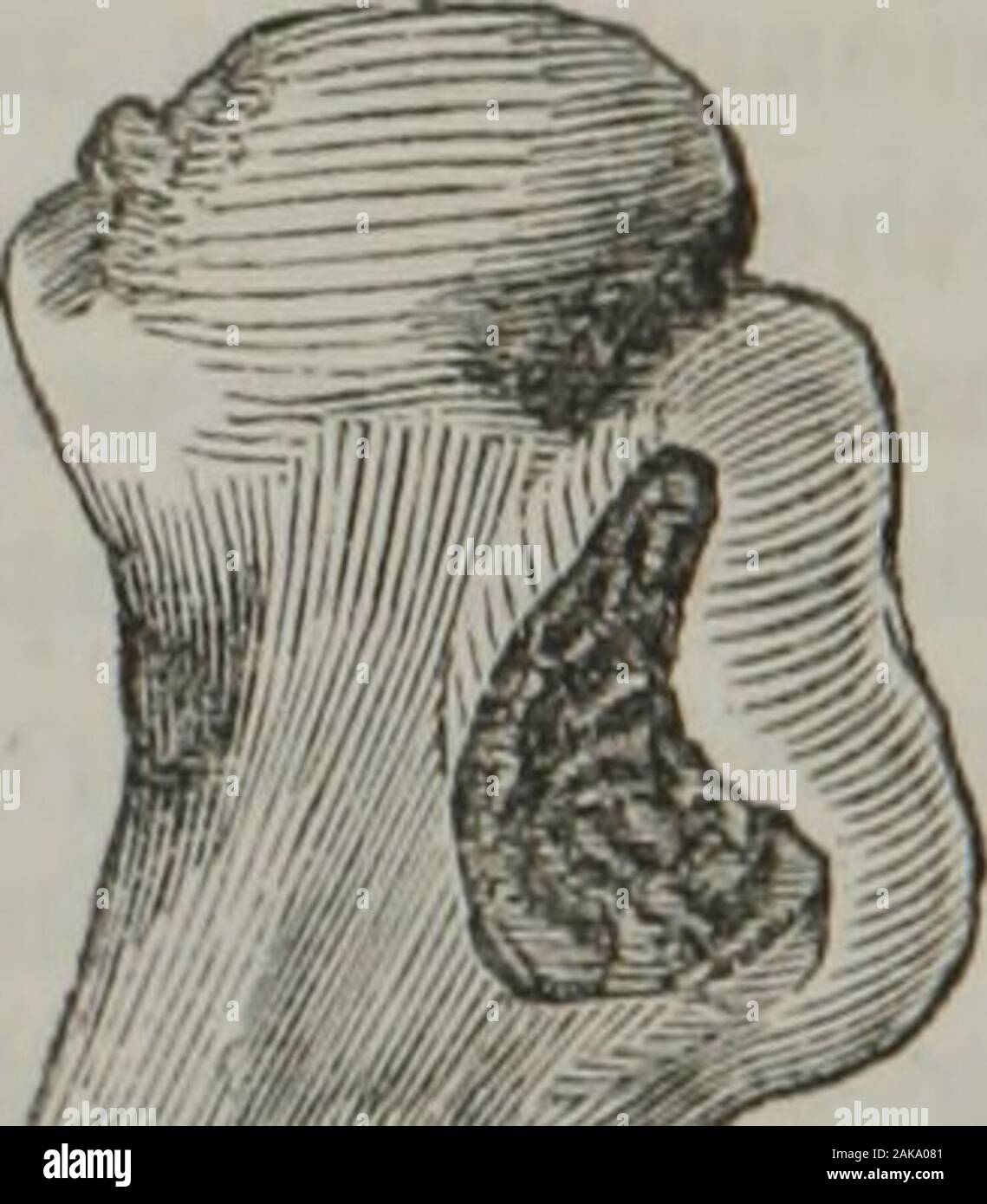 Elements of pathological anatomy Stock Photo - Alamy