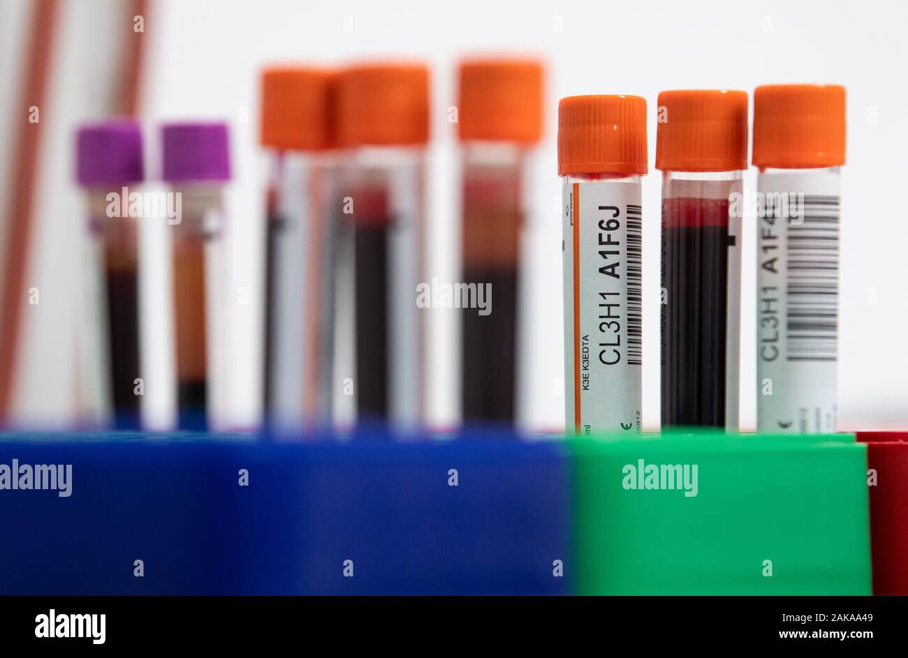 Container human blood hi-res stock photography and images - Alamy