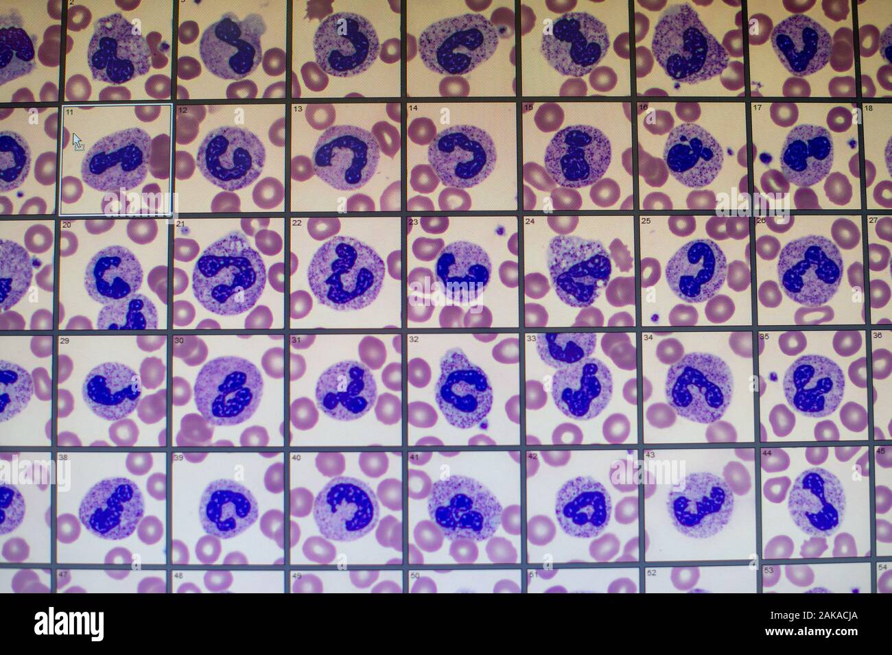 Live blood microscope hi-res stock photography and images - Alamy