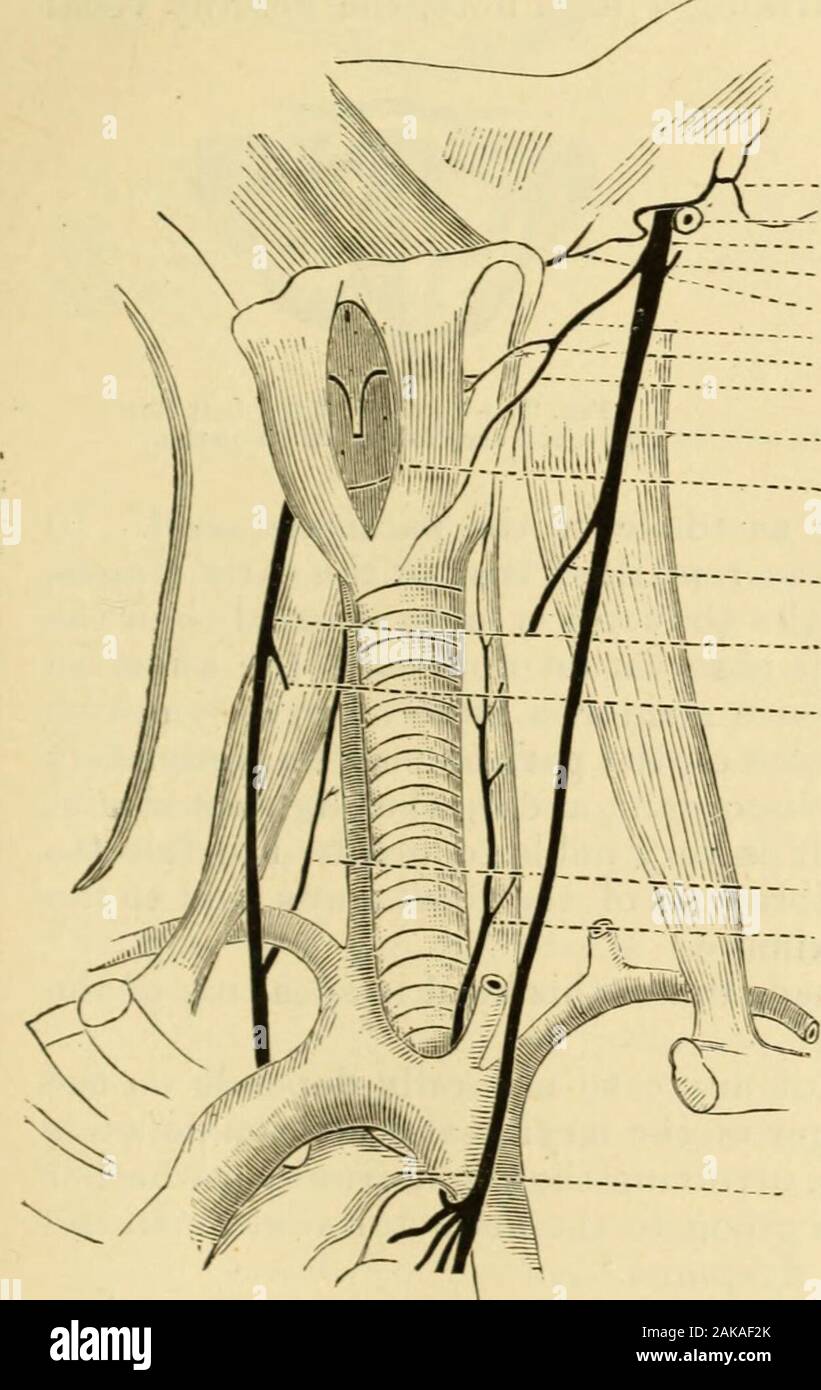 A manual of diseases of the throat and nose : including the pharynx ...