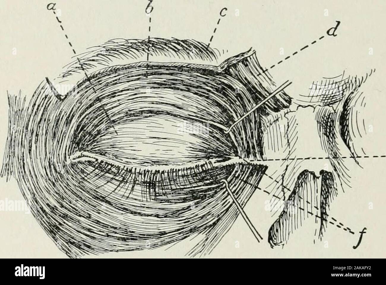 Palpebralis hi-res stock photography and images - Alamy
