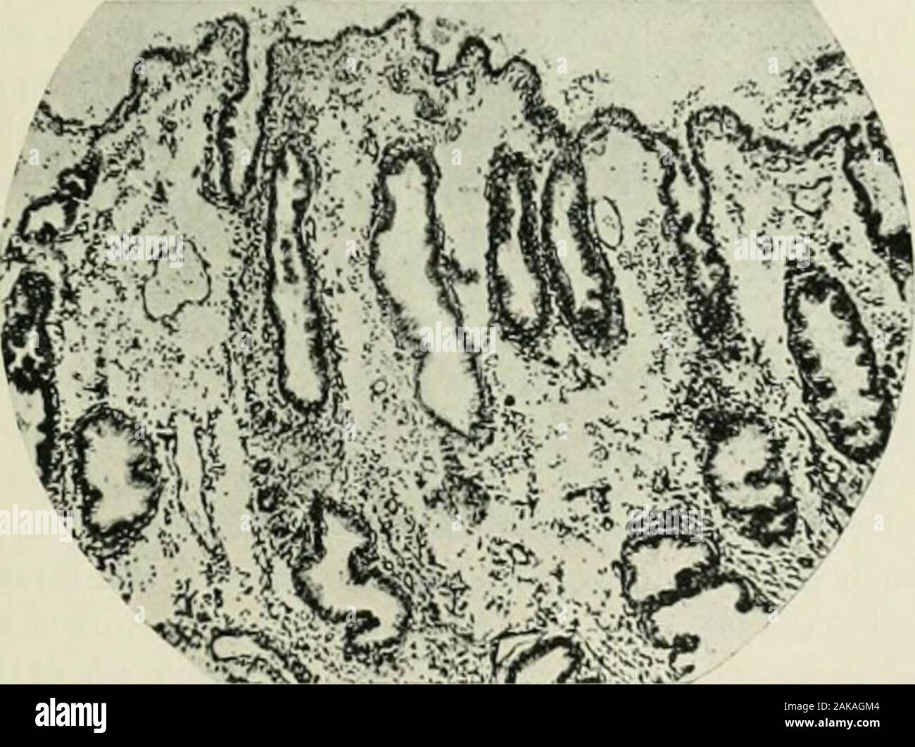 Gynecological diagnosis and pathology . II Fio. 76.—Mucous Membrane of ...