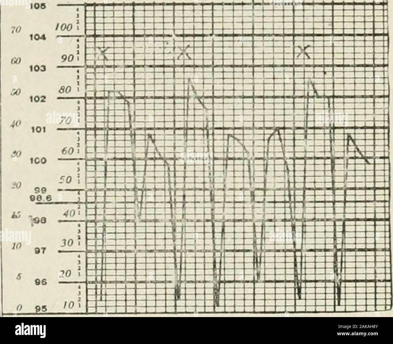 Tuberculin in diagnosis and treatment . Fis. 14. Pig. 15. Fig. 14 ...