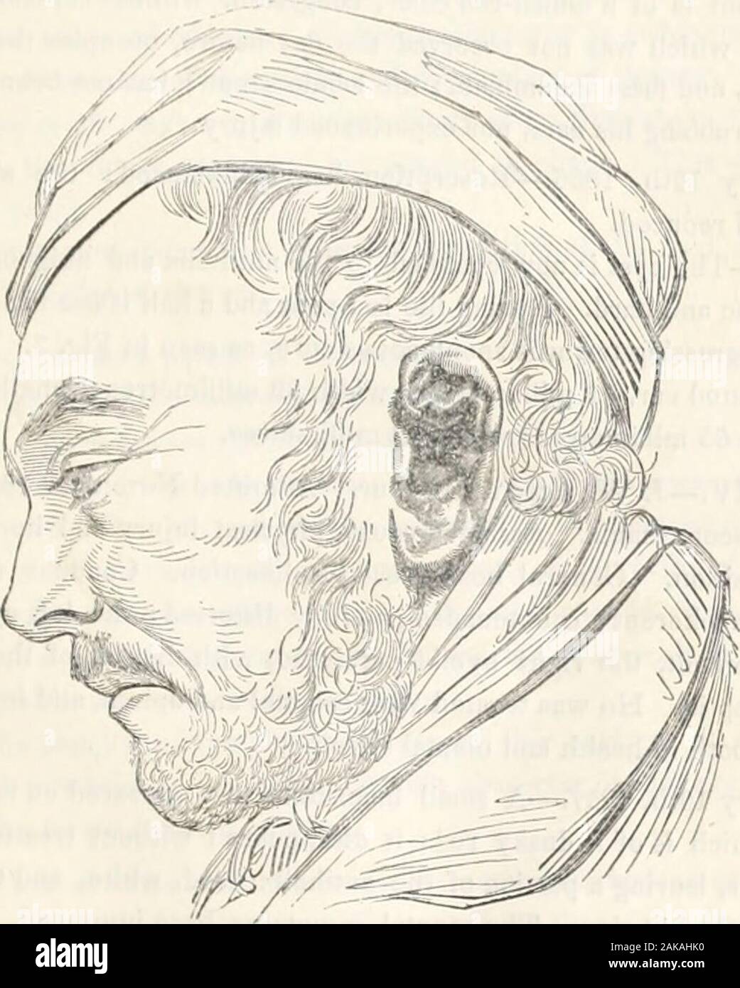 Cyst ear hi-res stock photography and images - Alamy