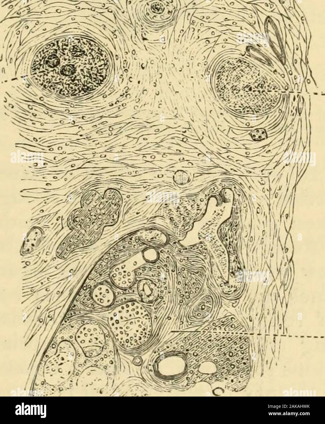 A manual of diseases of the throat and nose : including the pharynx ...