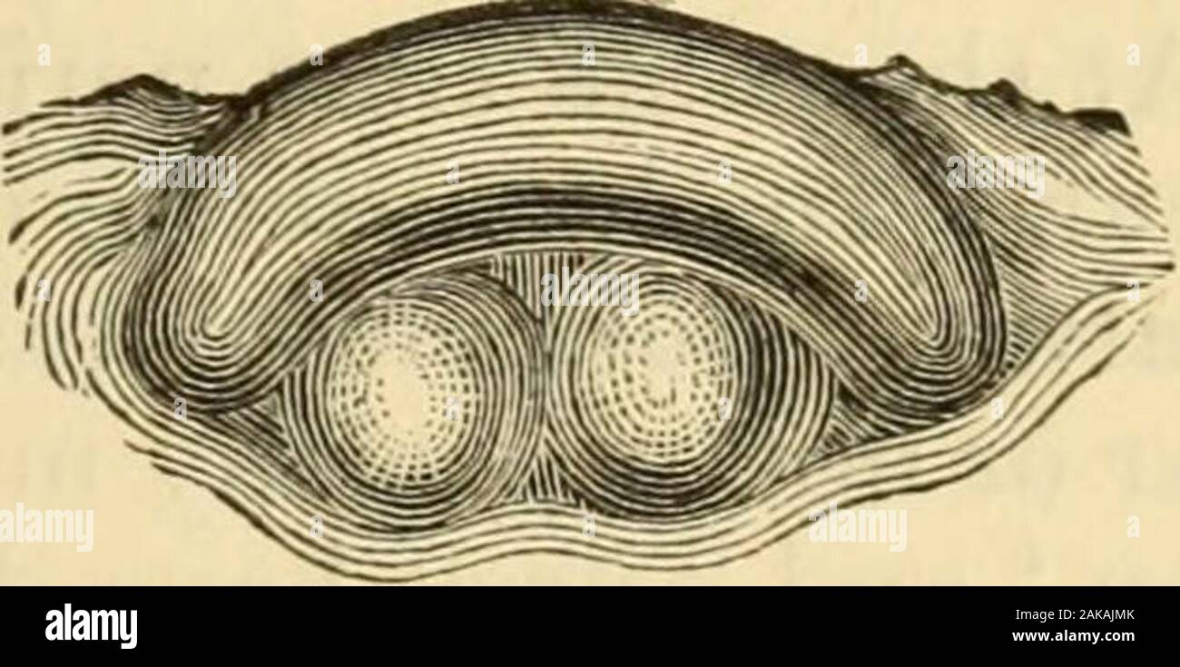 A manual of diseases of the throat and nose : including the pharynx ...
