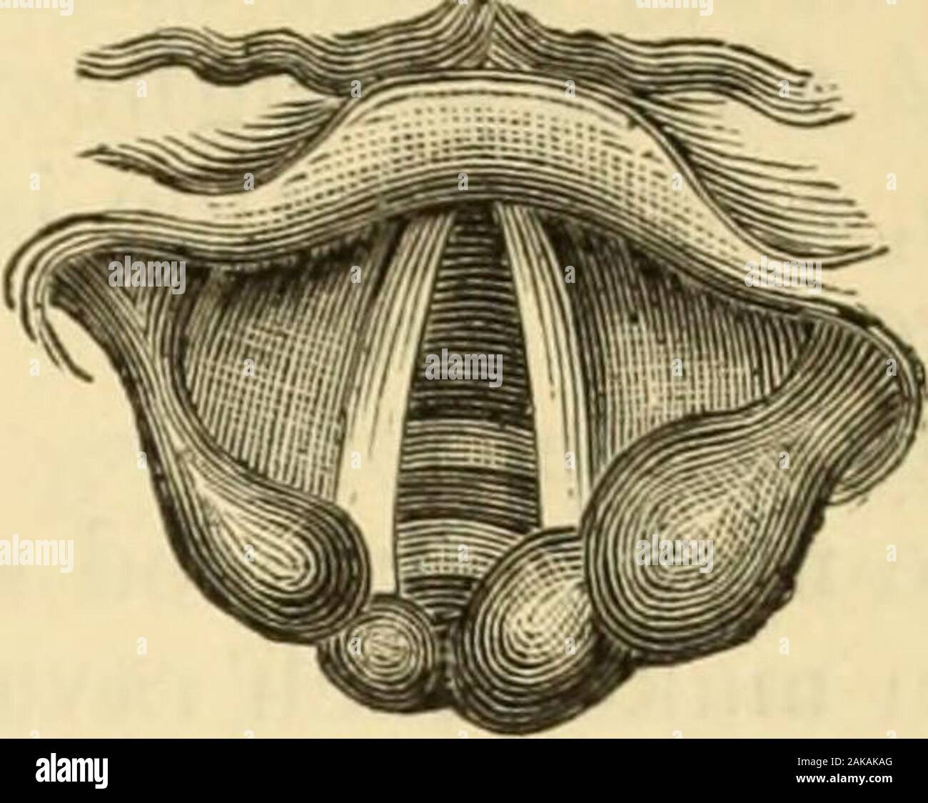 Laryngeal phthisis hi-res stock photography and images - Alamy