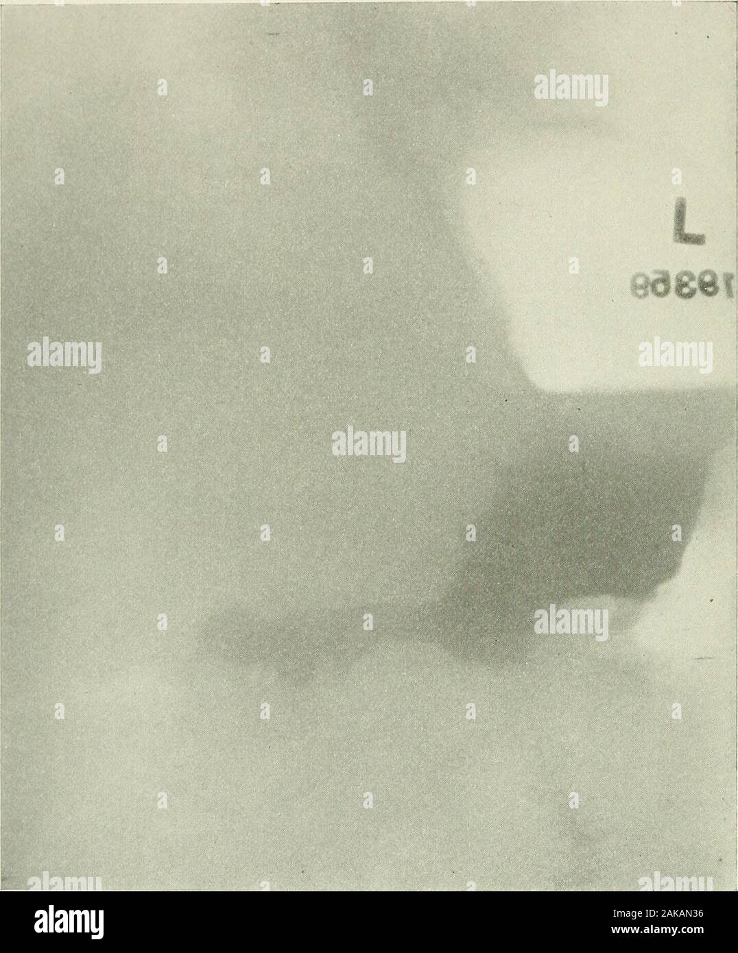 Epigastrium hi-res stock photography and images - Alamy