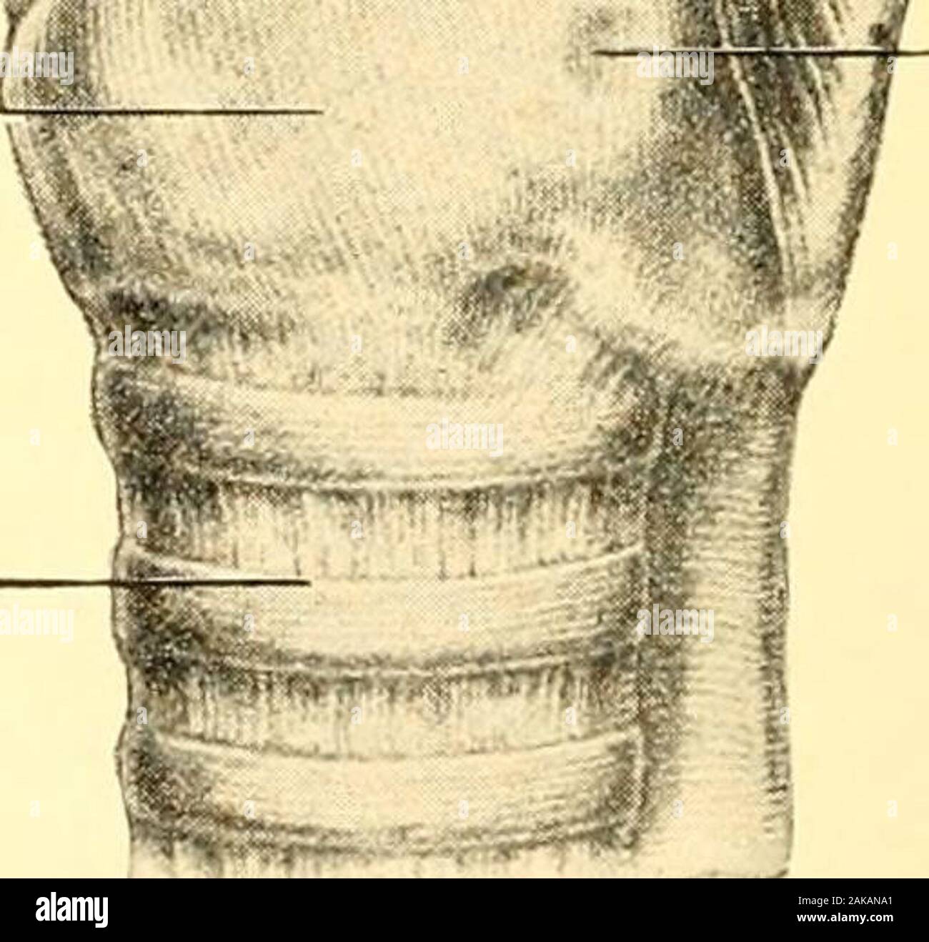 Arytenoid fold hi-res stock photography and images - Alamy