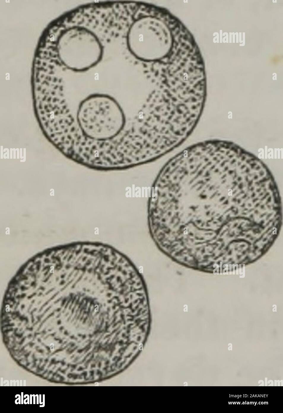 Elements of pathological anatomy . **£/ Fig. 11 Stock Photo - Alamy