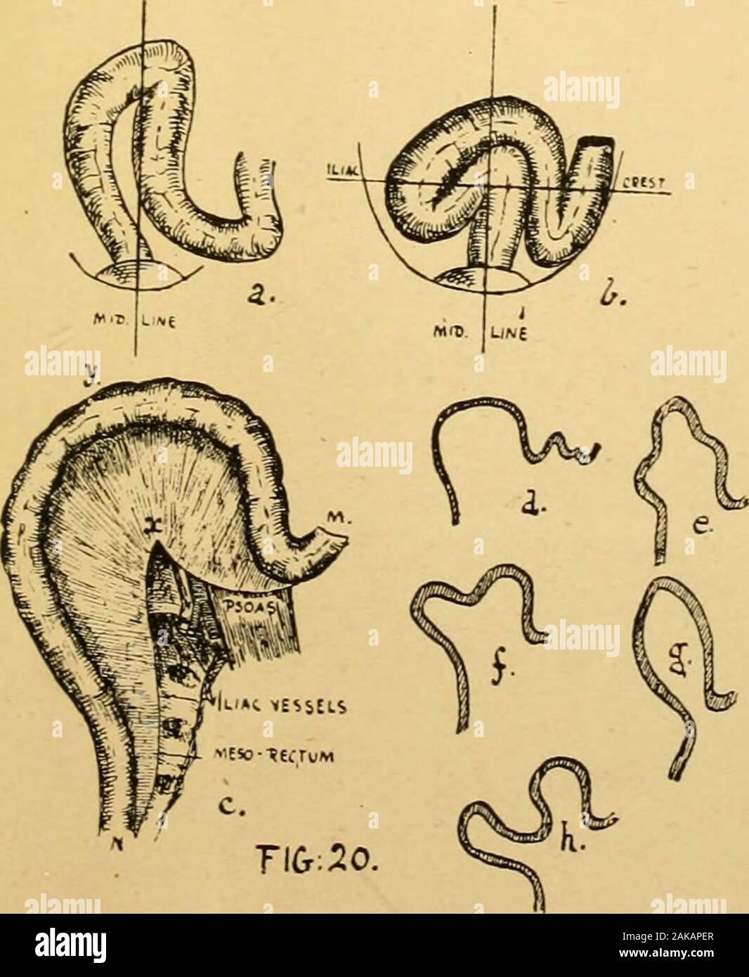 The anatomy of the intestinal canal and peritoneum in man . Vis. 13 ...