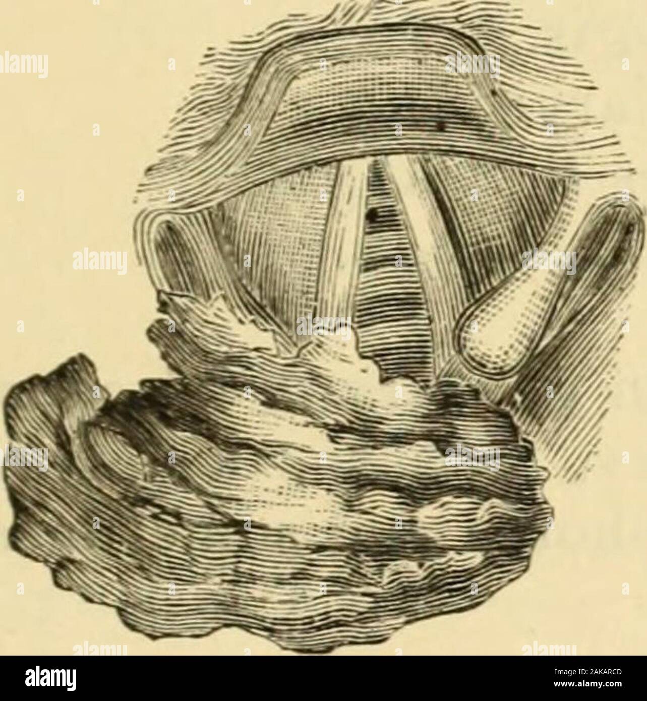 Trachea mucous membrane hi-res stock photography and images - Alamy