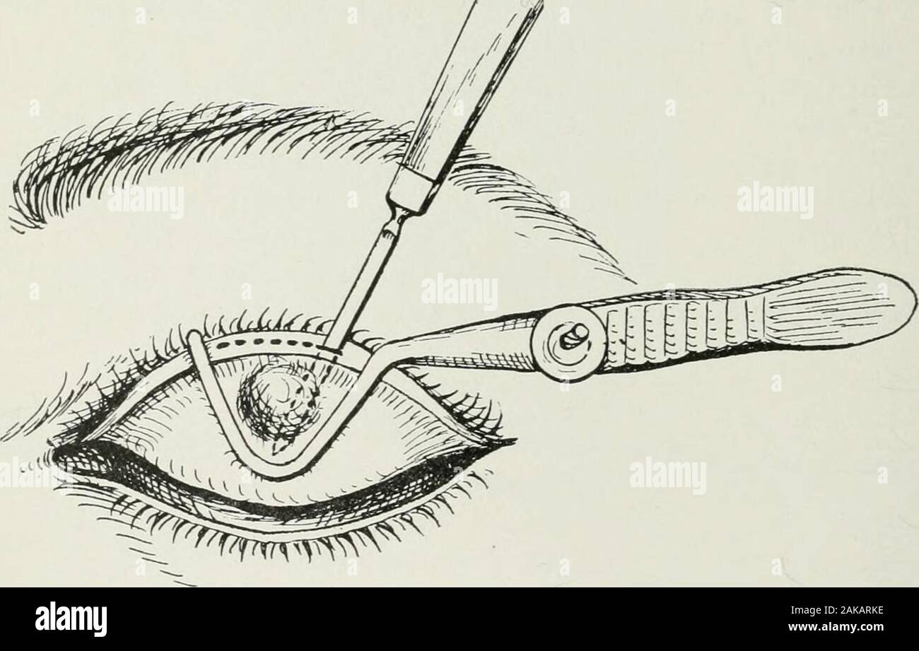 The American encyclopedia and dictionary of ophthalmology Edited by ...
