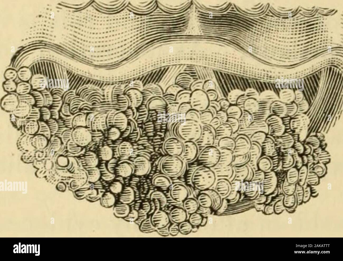 A manual of diseases of the throat and nose : including the pharynx ...