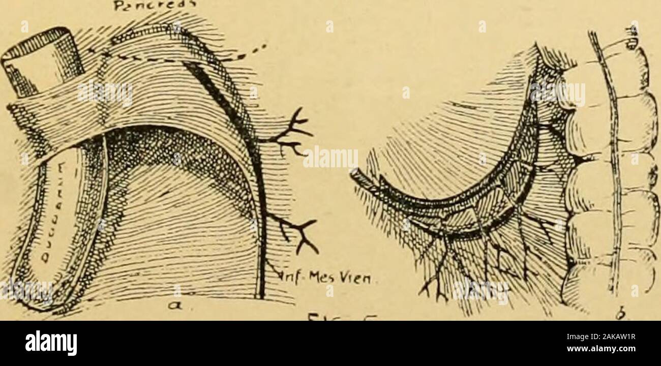 The anatomy of the intestinal canal and peritoneum in man Stock Photo ...