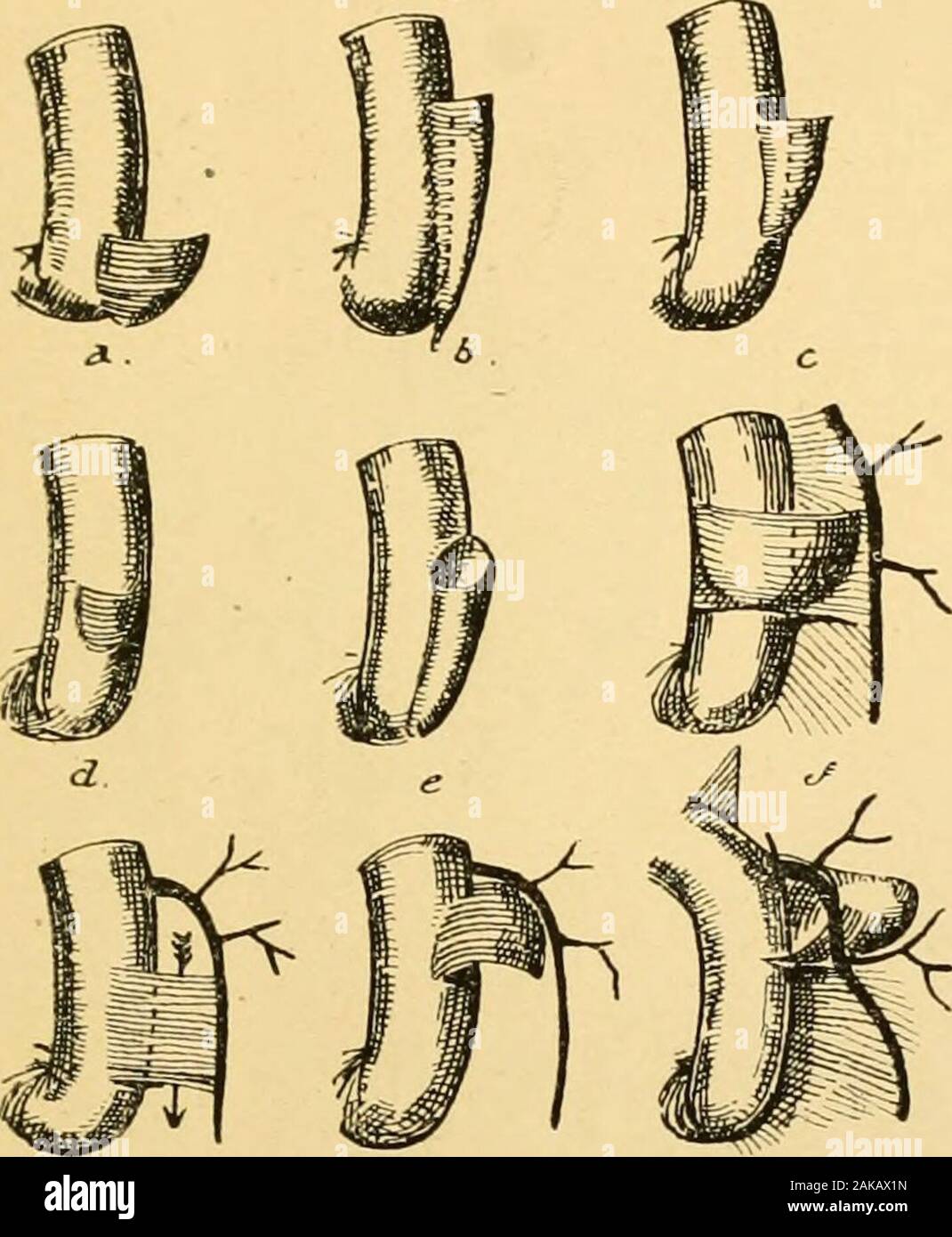 The anatomy of the intestinal canal and peritoneum in man . Fife- a ...