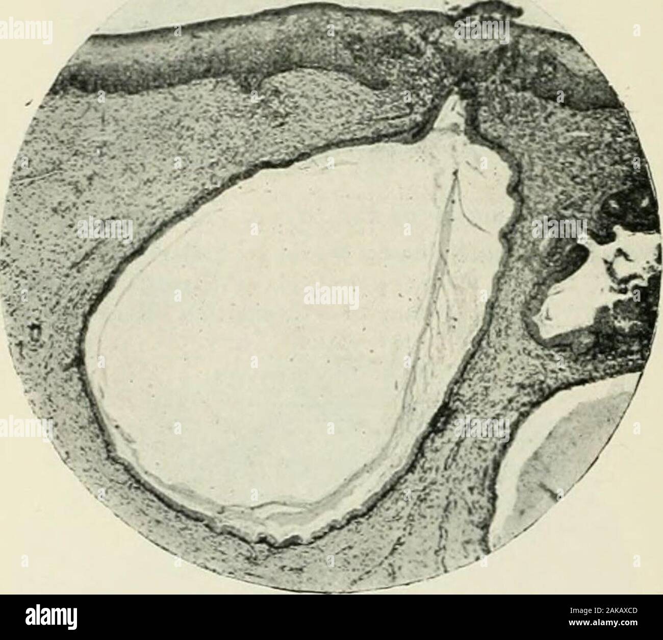 Gynecological diagnosis and pathology . r healing of a cervical erosion ...