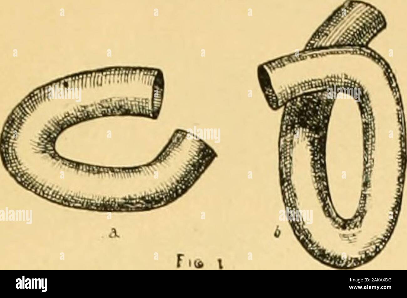 Sigmoid artery hi-res stock photography and images - Alamy