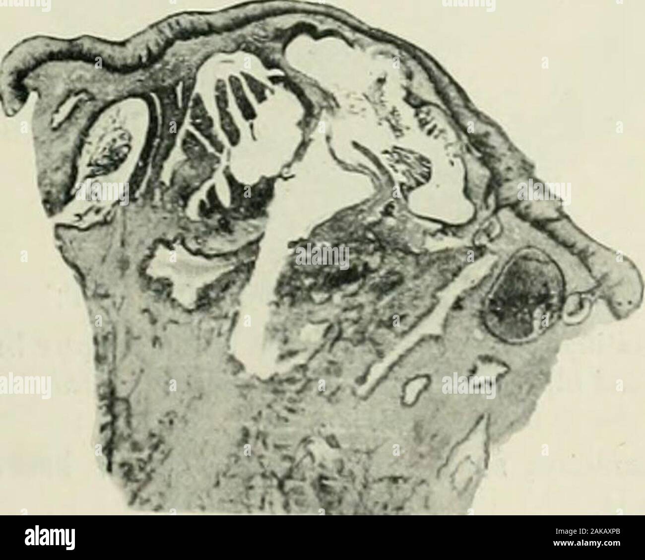 Gynecological diagnosis and pathology . th the single layer ofcolumnar ...