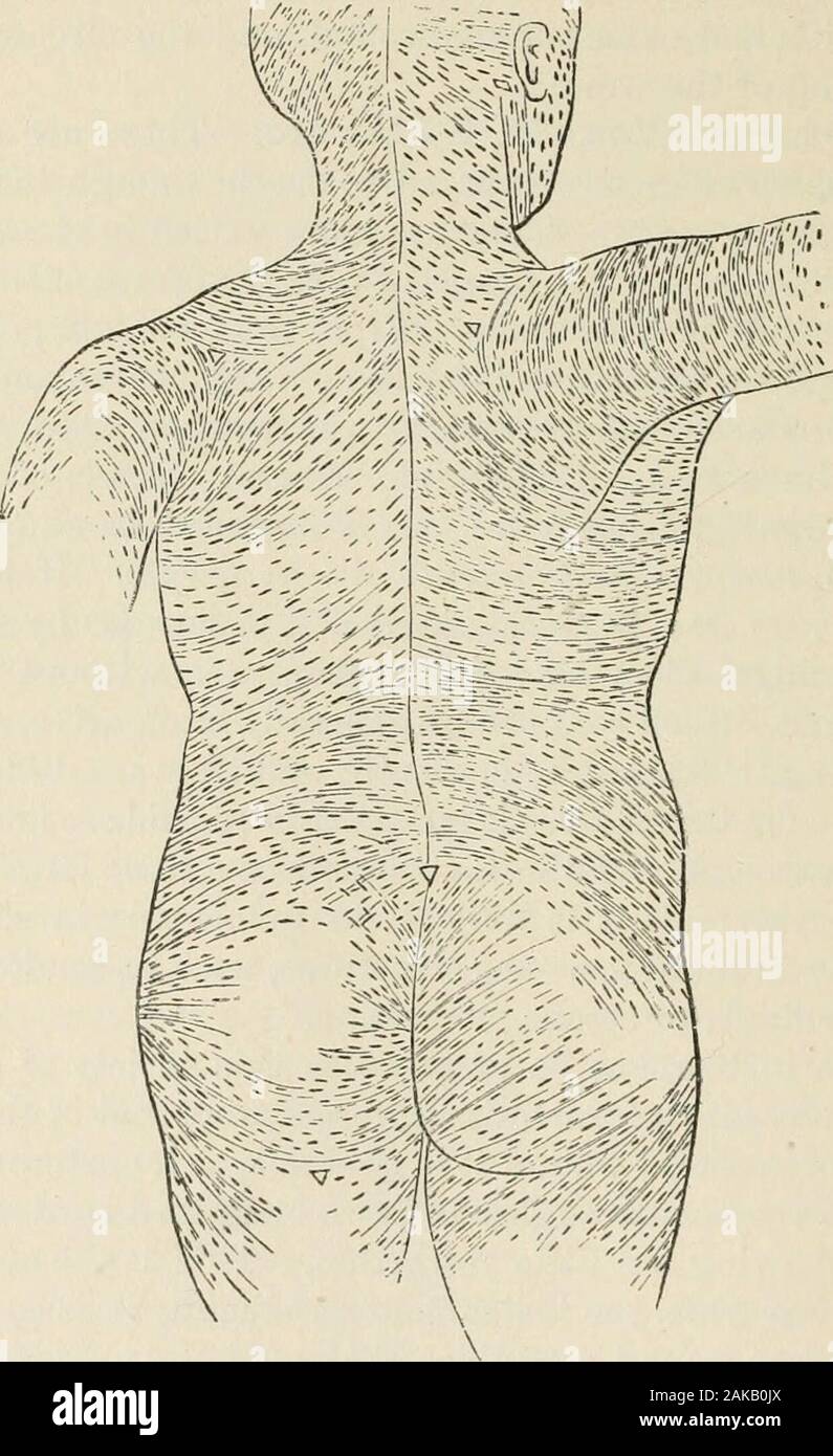 Medical jurisprudence, forensic medicine and toxicology . und it is ...