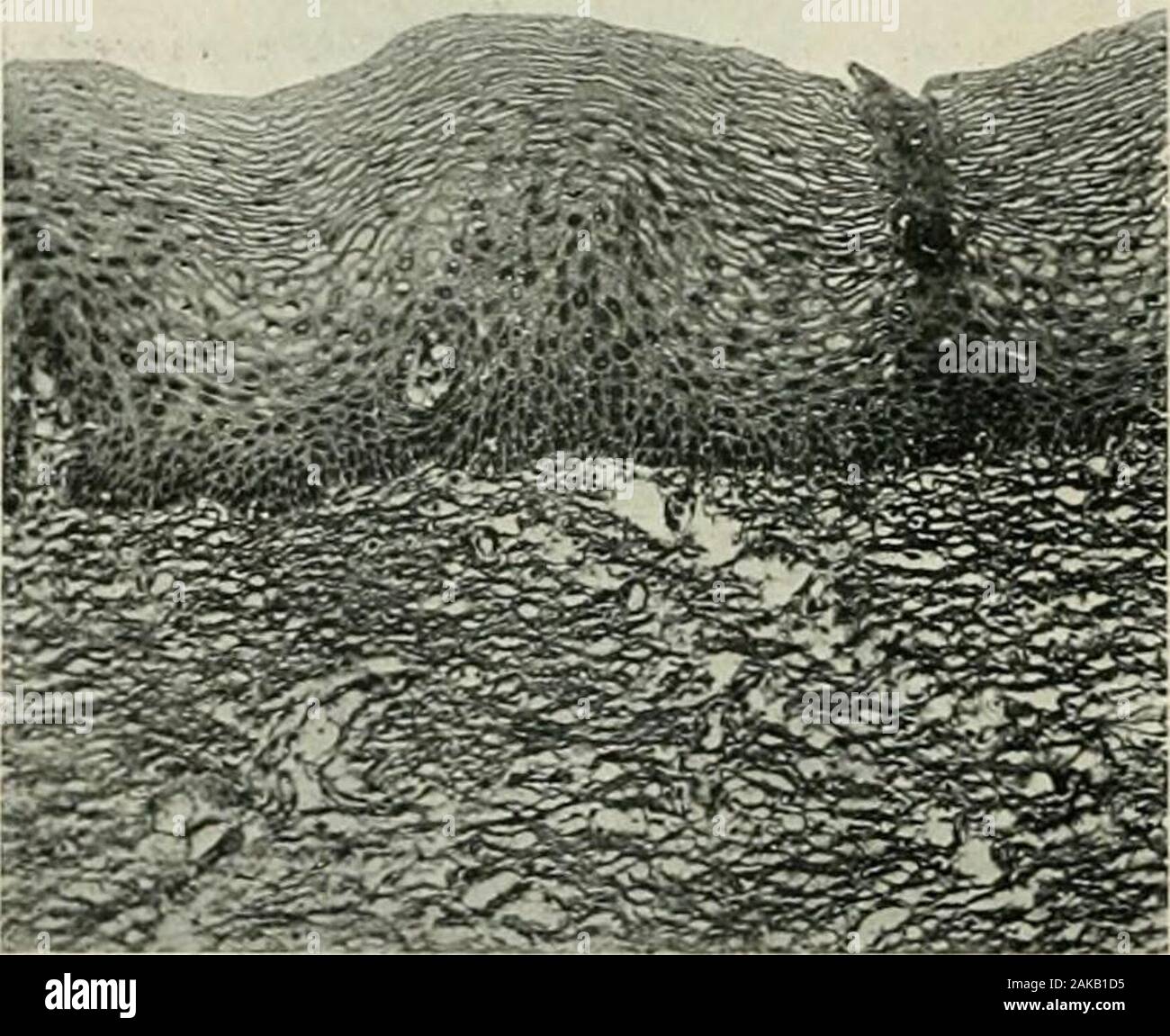 Posterior cervix hi-res stock photography and images - Alamy