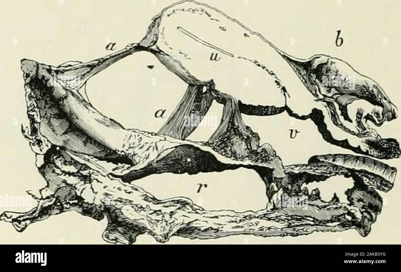Retroverted uterus hi-res stock photography and images - Alamy