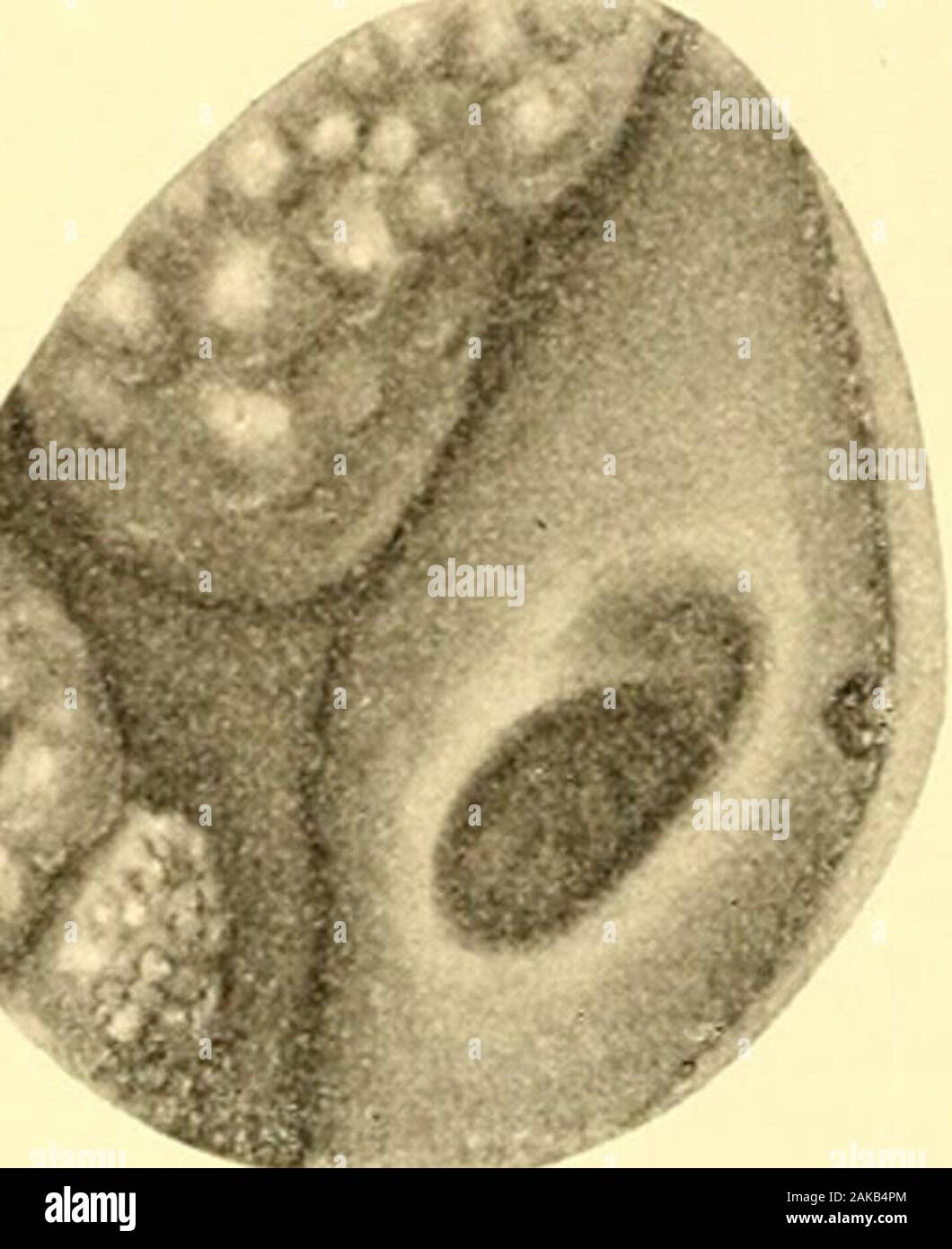 Diseases of the nose and throat . offensive and maybe tinged with blood ...