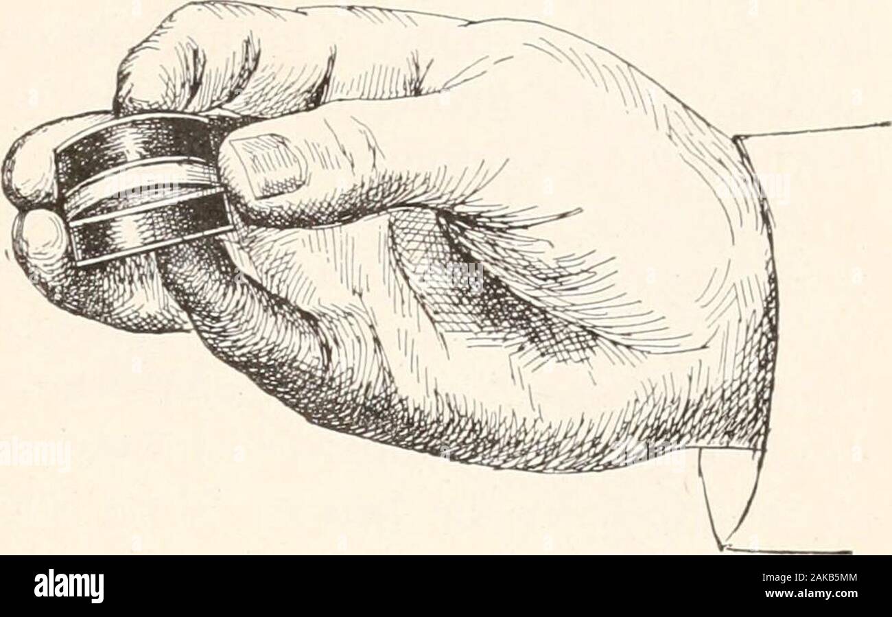 Cyanide pill hi-res stock photography and images - Alamy