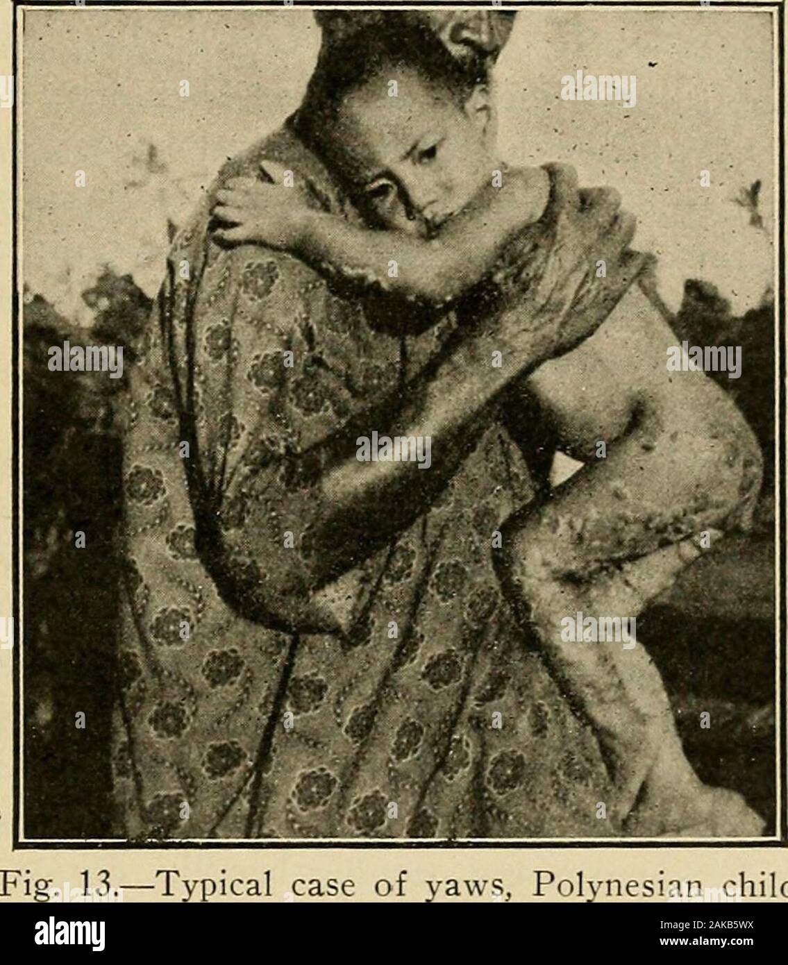 Handbook of medical treatment . as in simple fever. The prevention of ...