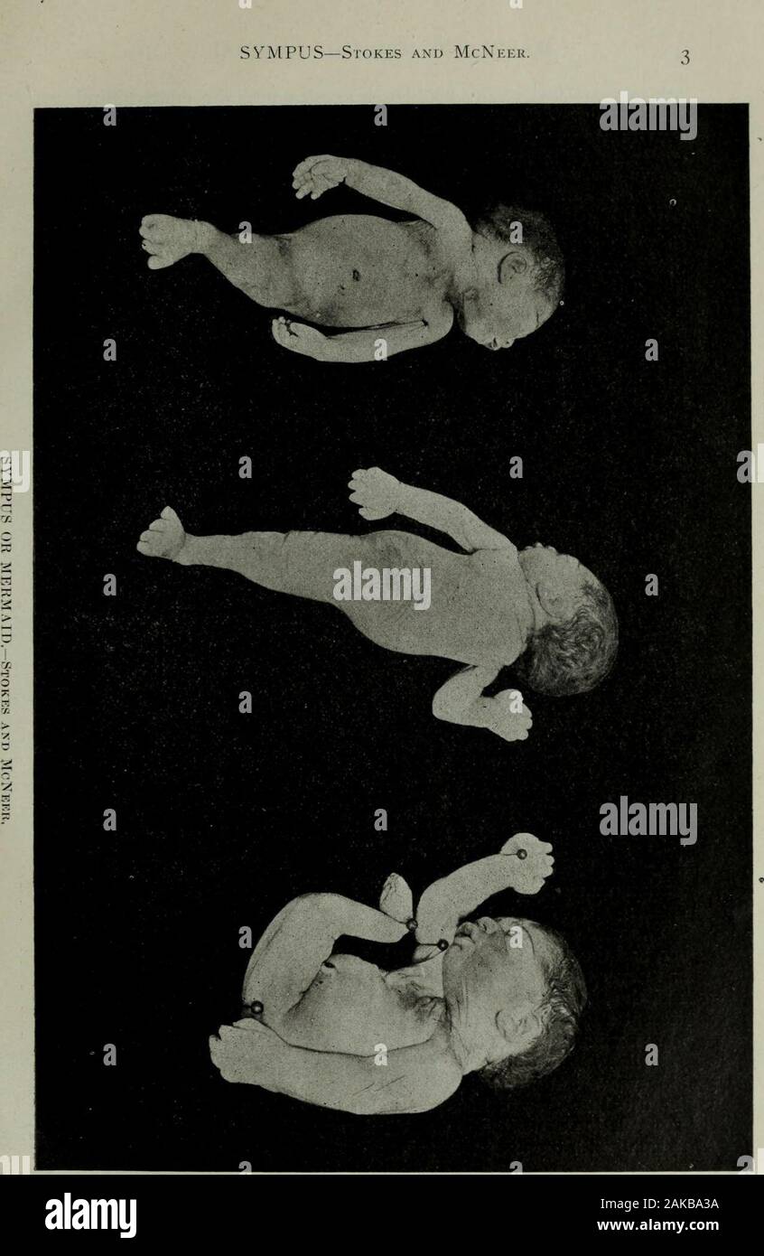 Cotyloid hi-res stock photography and images - Alamy